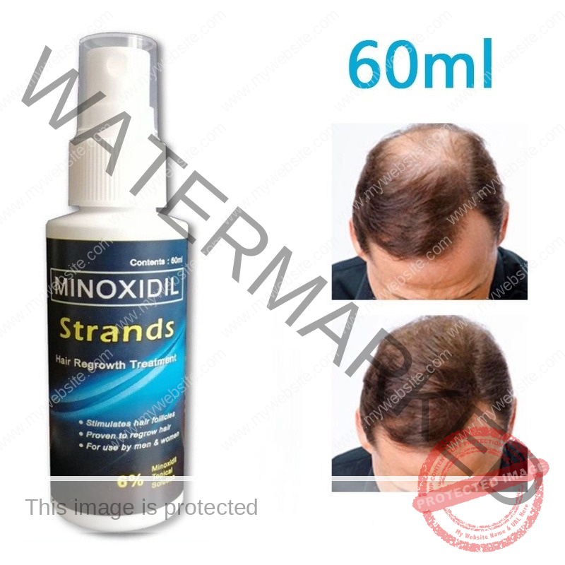 Minoxidil Strands 6% Minoxidil Topical Solution (60ml per bottle) Hair ...